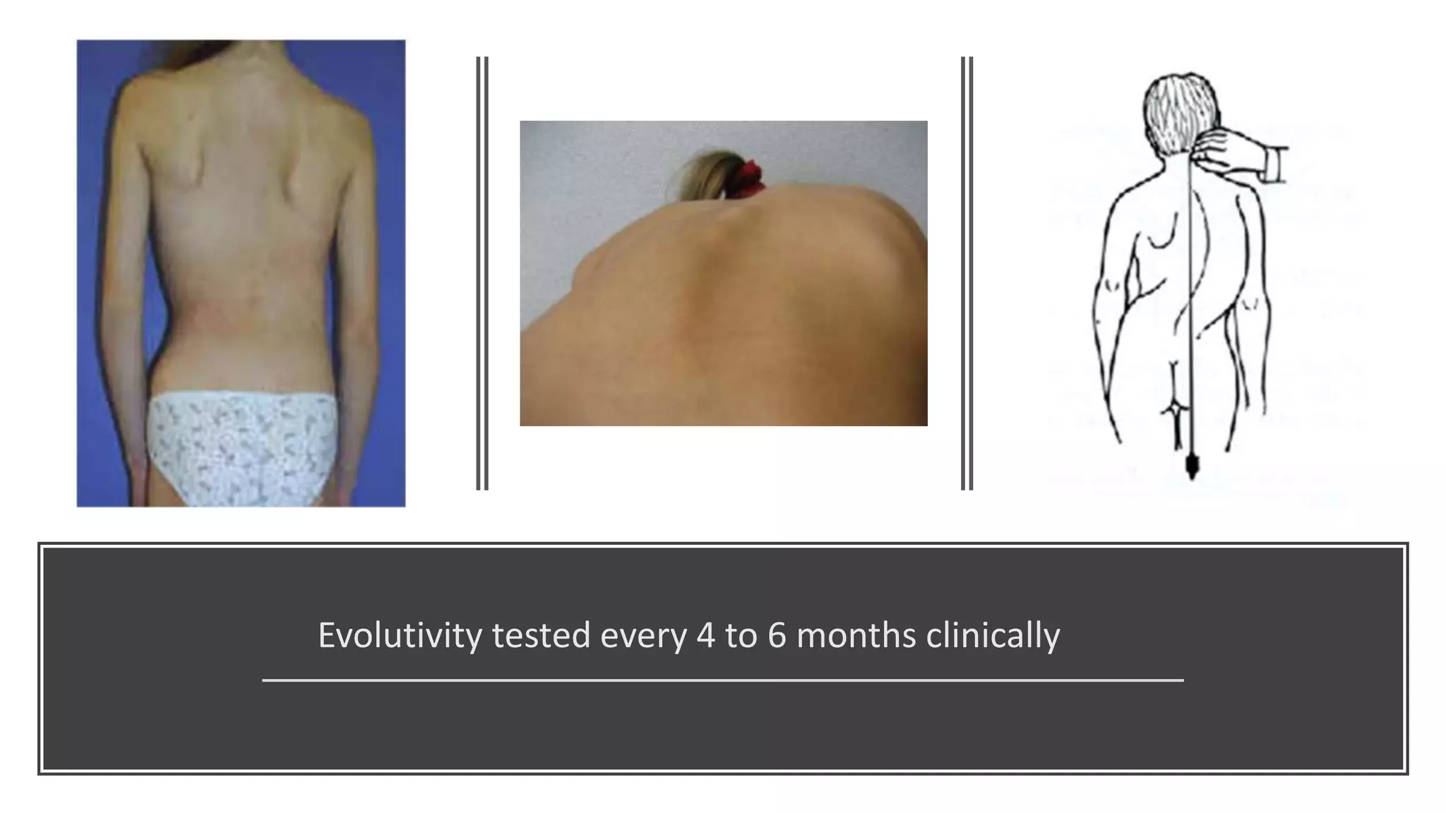 Digitized manual palpation: a new method of evaluating posture and its ...