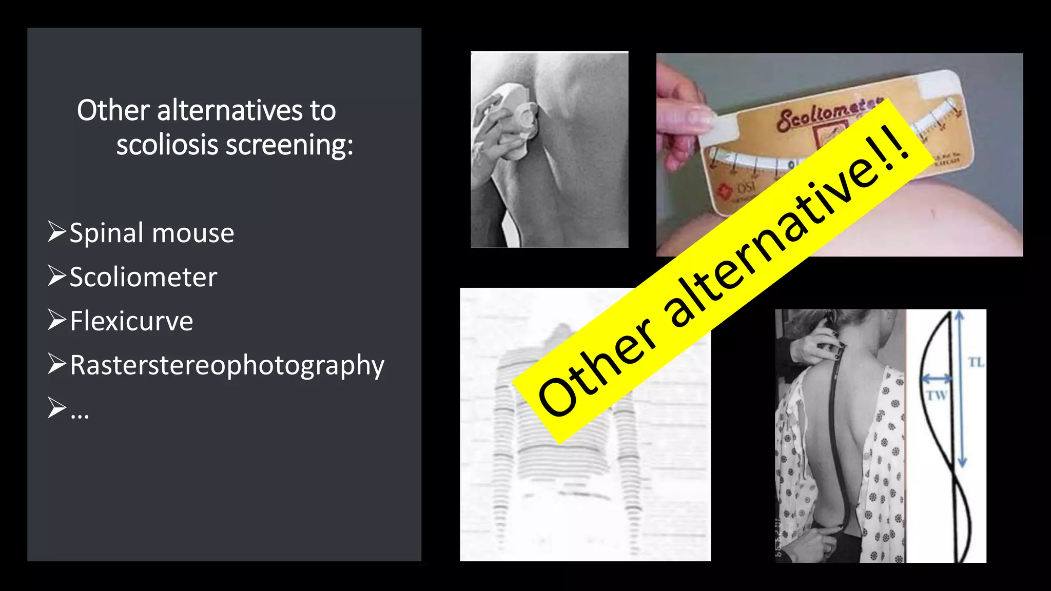 Digitized manual palpation: a new method of evaluating posture and its ...