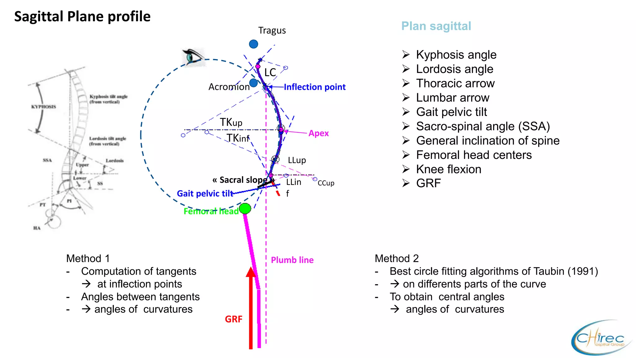 Digitized manual palpation: a new method of evaluating posture and its ...