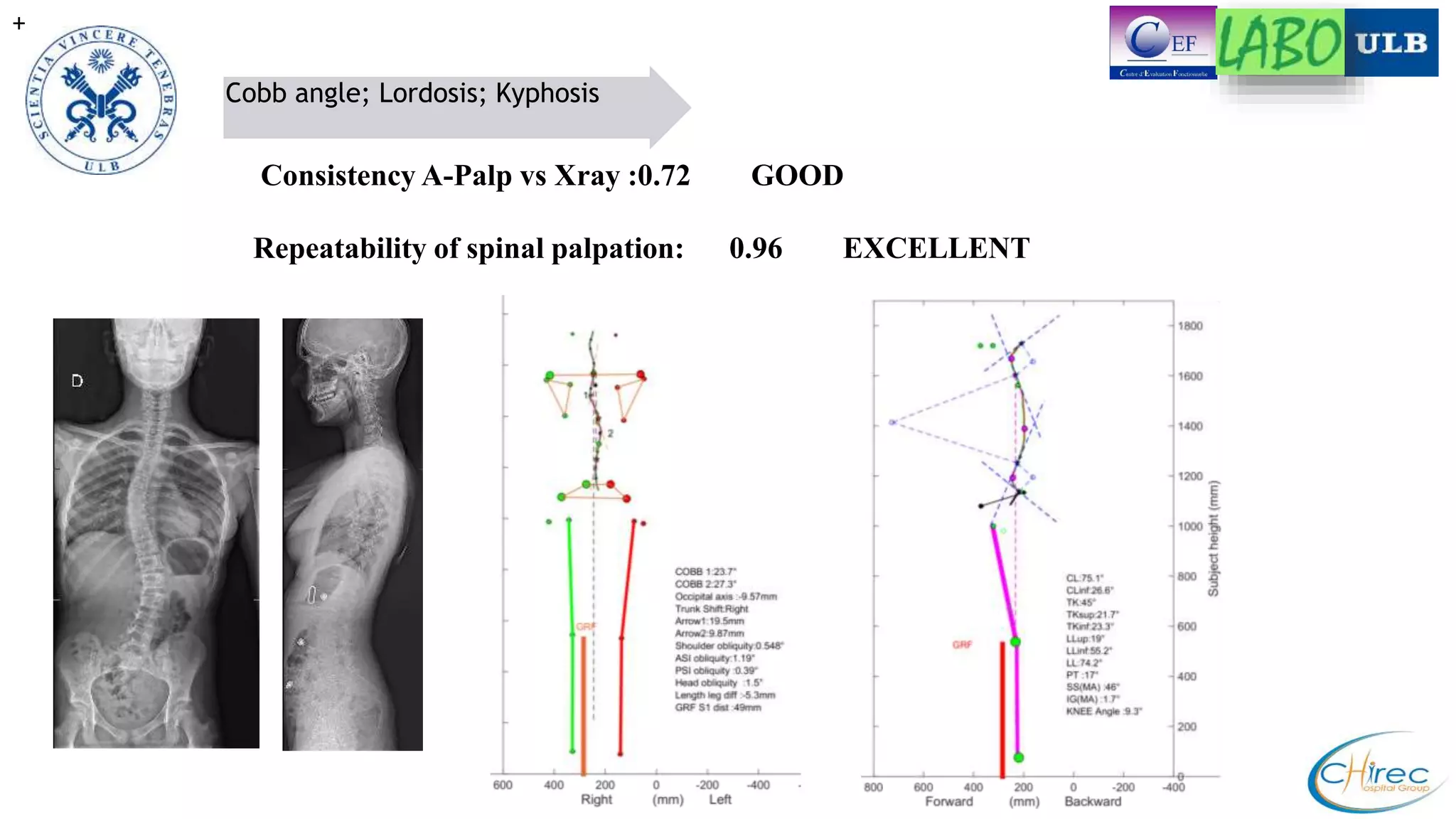 Digitized manual palpation: a new method of evaluating posture and its ...