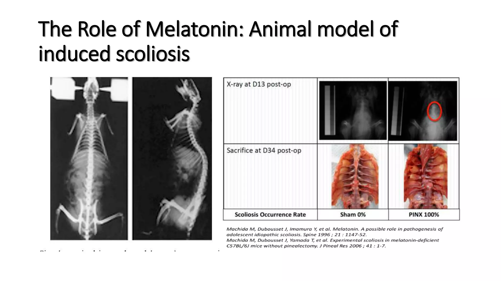 Digitized manual palpation: a new method of evaluating posture and its ...