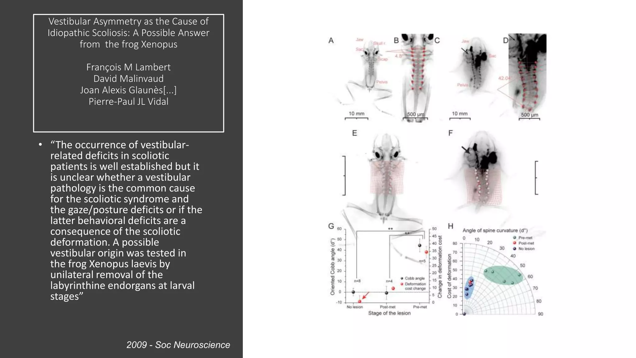 Digitized manual palpation: a new method of evaluating posture and its ...