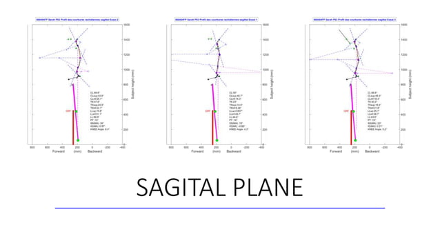 Digitized manual palpation: a new method of evaluating posture and its ...