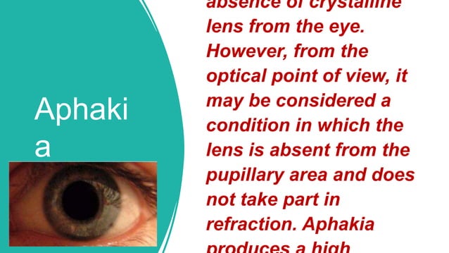Presentation Aphakia ppt.pptxmmmmmmmmmmmmm | PPTX