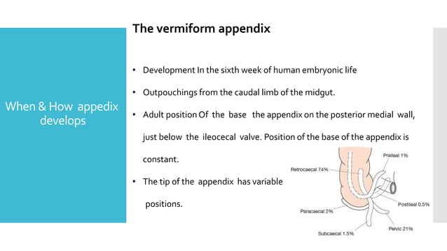 Acute appendicitis presentation.pptx