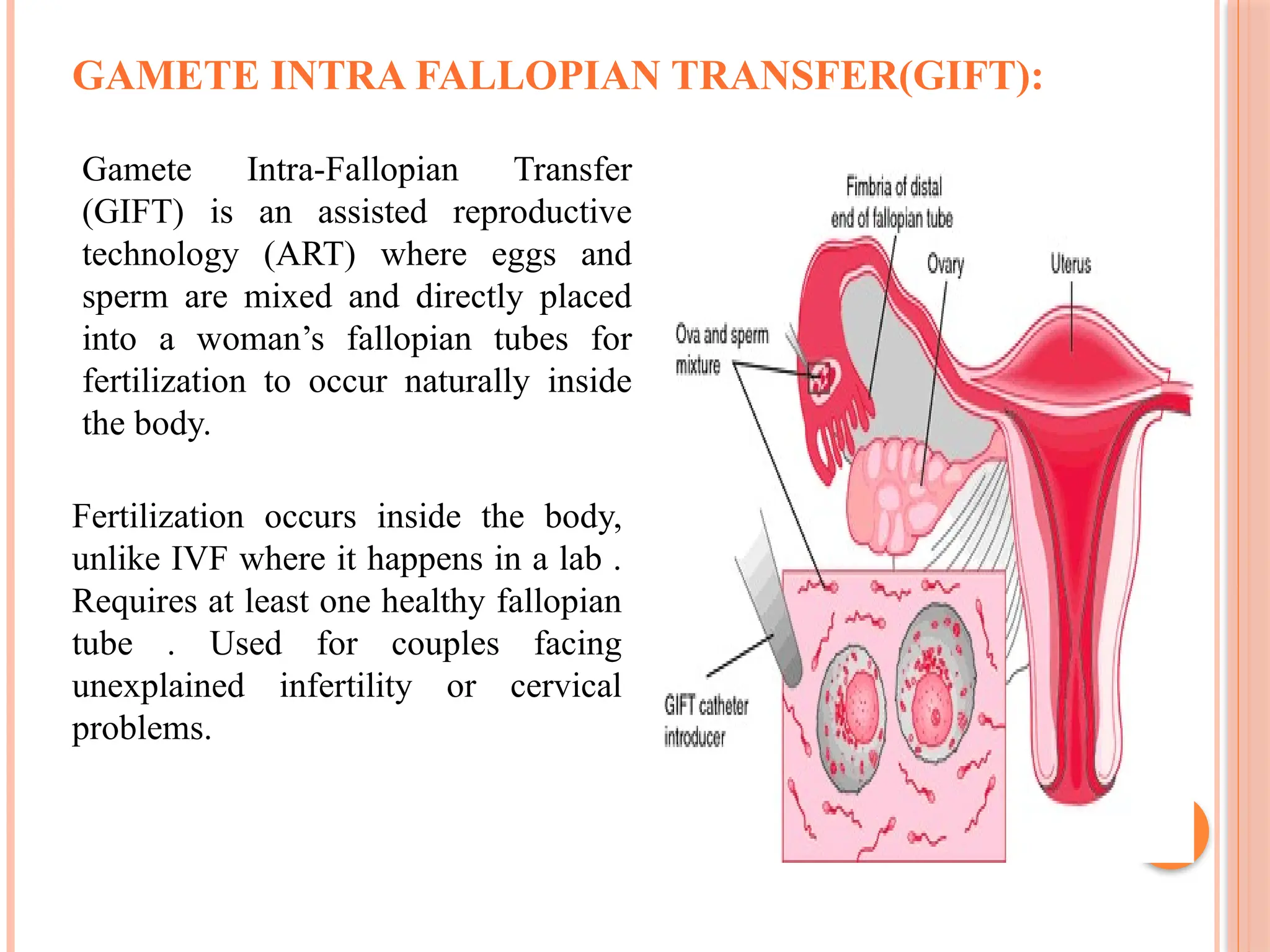 IVF and Infertility measures(Embryology).pptx