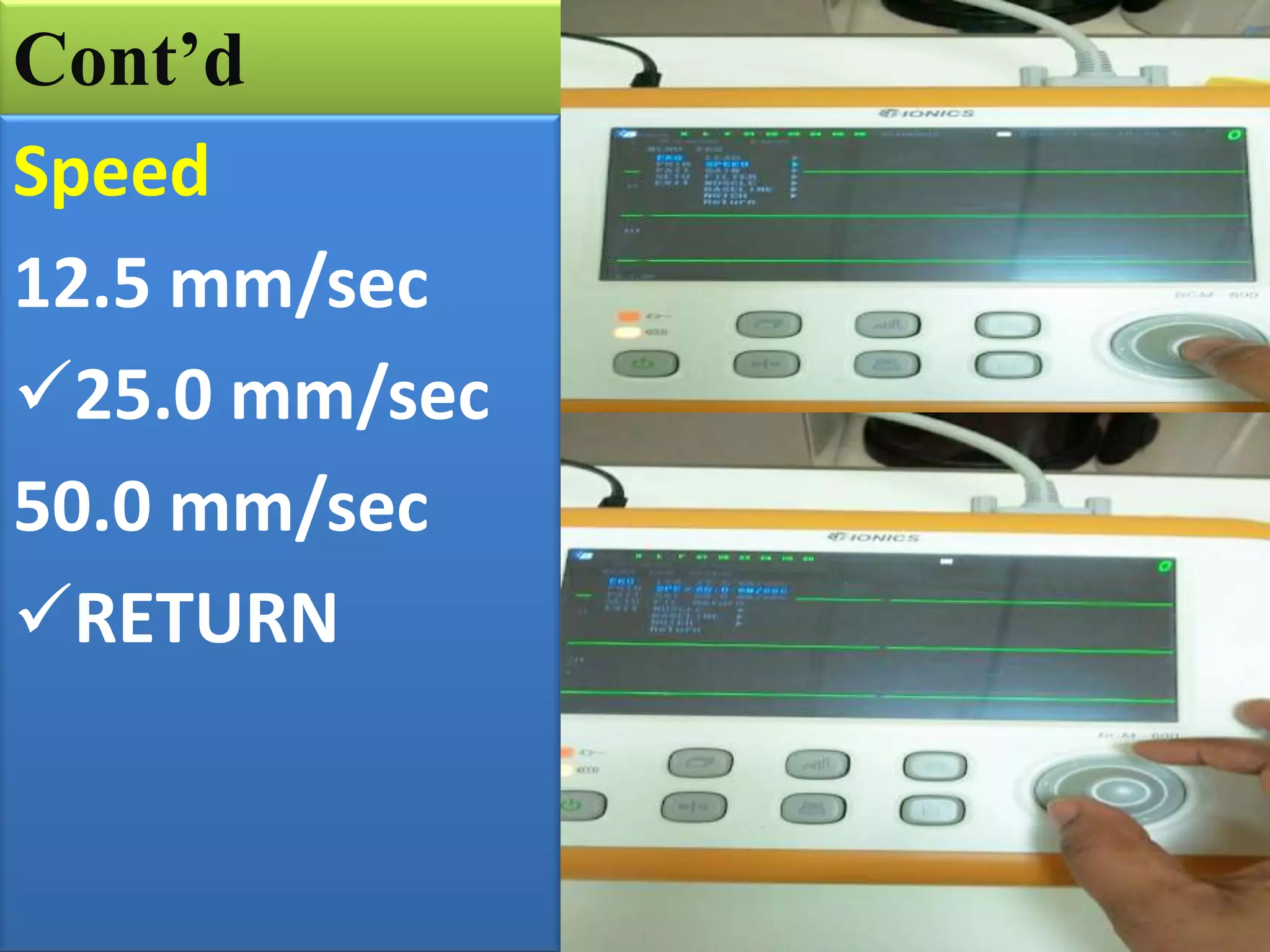 NURSING PROCEDURE OBTAIN 12 LEAD ECG | PPTX