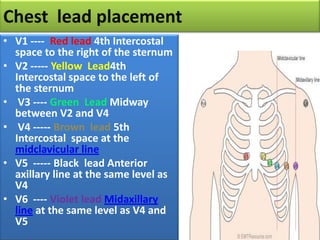 NURSING PROCEDURE OBTAIN 12 LEAD ECG | PPTX