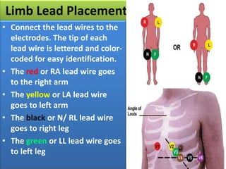 12 Lead Ecg Placement Color Coded