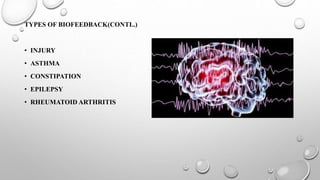 Biofeed back | PPTX | Physical Therapy | Wellness