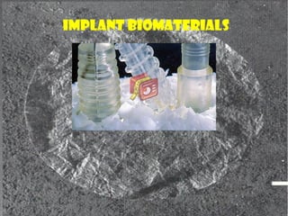 implant biomaterial | PPT