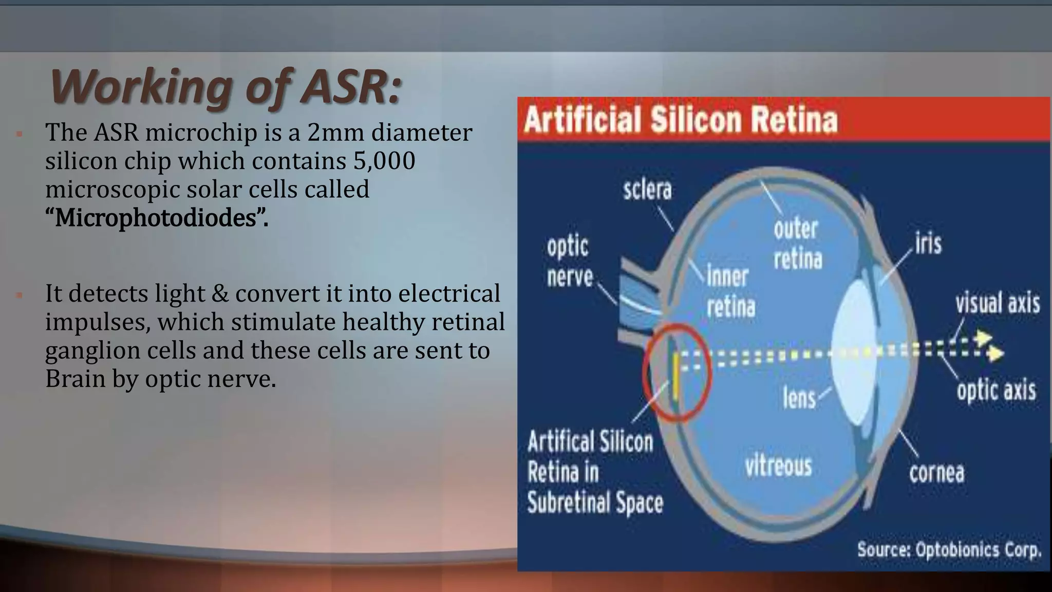 presentation_bionic_eye_1509629649_211160.pptx