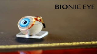presentation_bionic_eye_1509629649_211160.pptx
