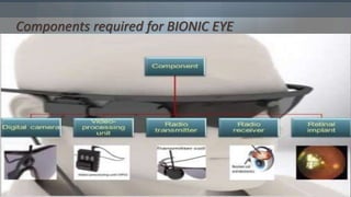 presentation_bionic_eye_1509629649_211160.pptx