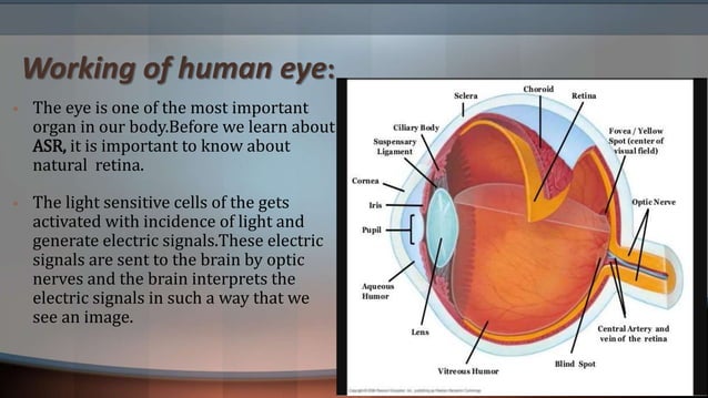 presentation_bionic_eye_1509629649_211160.pptx