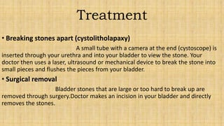 Bladder stone Presentation | PPTX