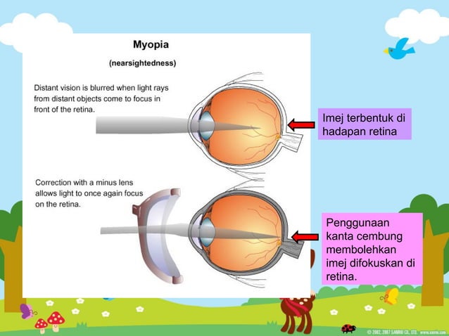 Masalah Penglihatan | PPT