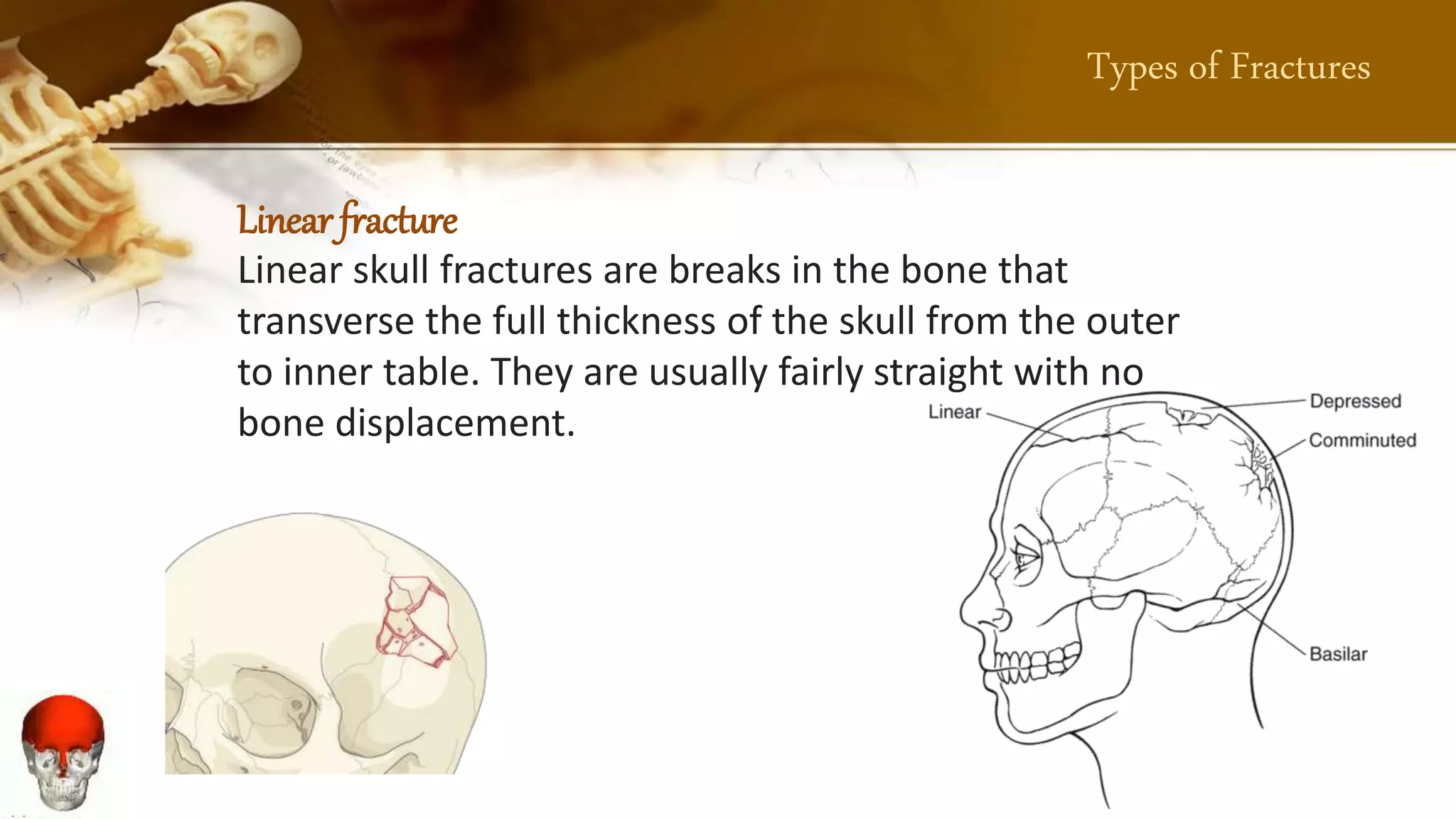 Clinical Anatomy of Skull (Presentation by Muhammad Arslan Yasin ...