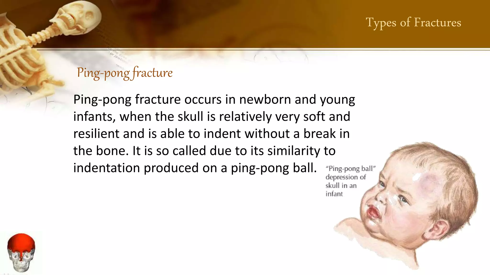 Clinical Anatomy of Skull (Presentation by Muhammad Arslan Yasin ...
