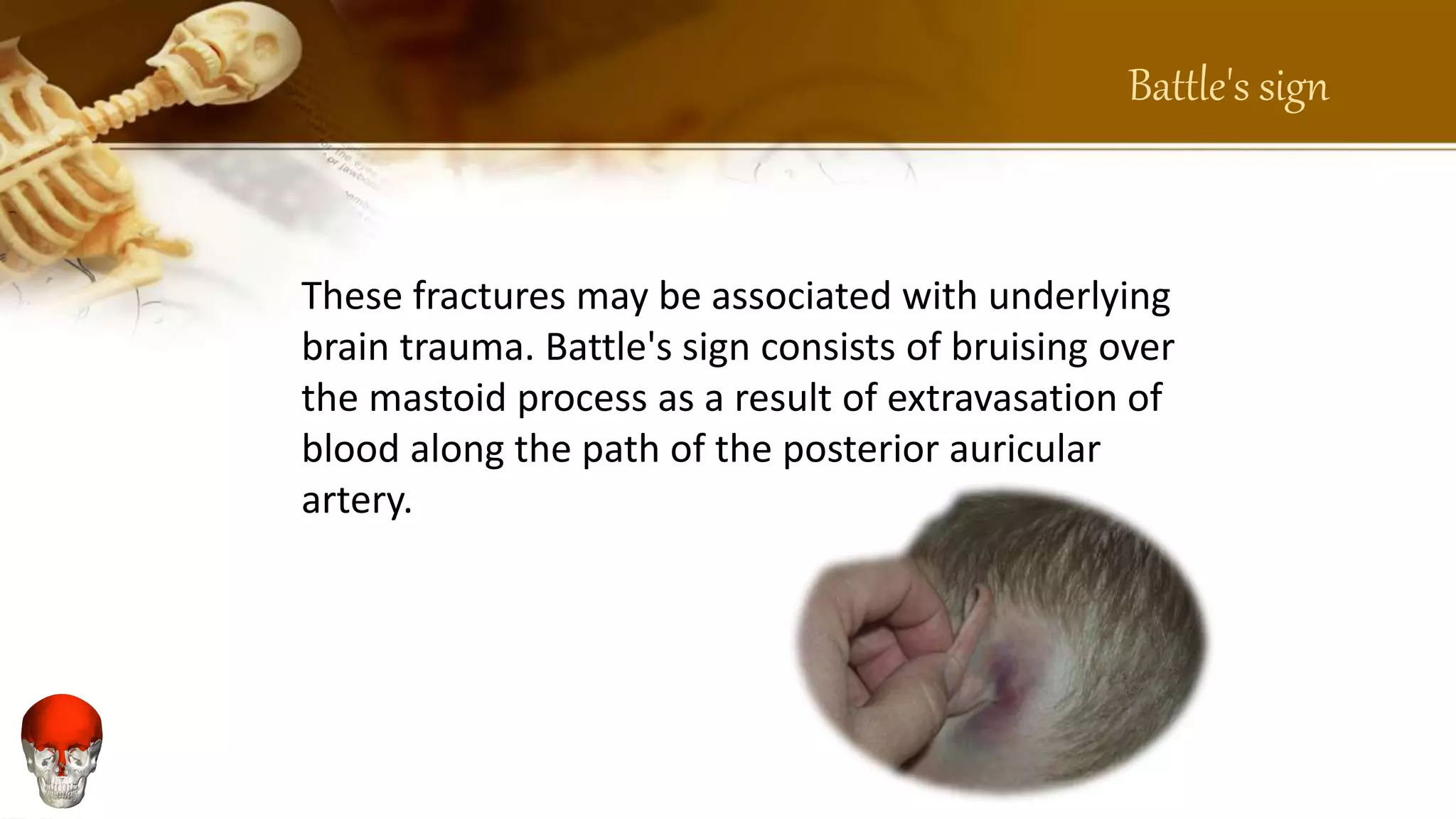 Clinical Anatomy of Skull (Presentation by Muhammad Arslan Yasin ...