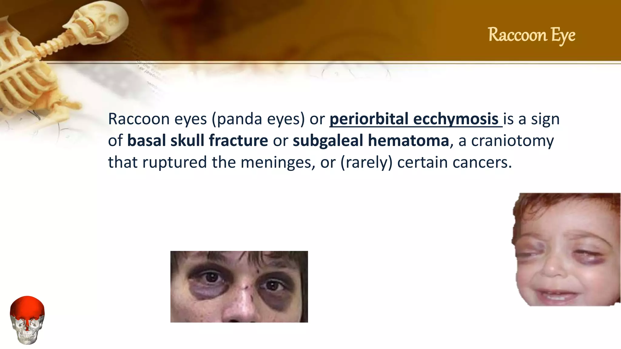Clinical Anatomy of Skull (Presentation by Muhammad Arslan Yasin ...