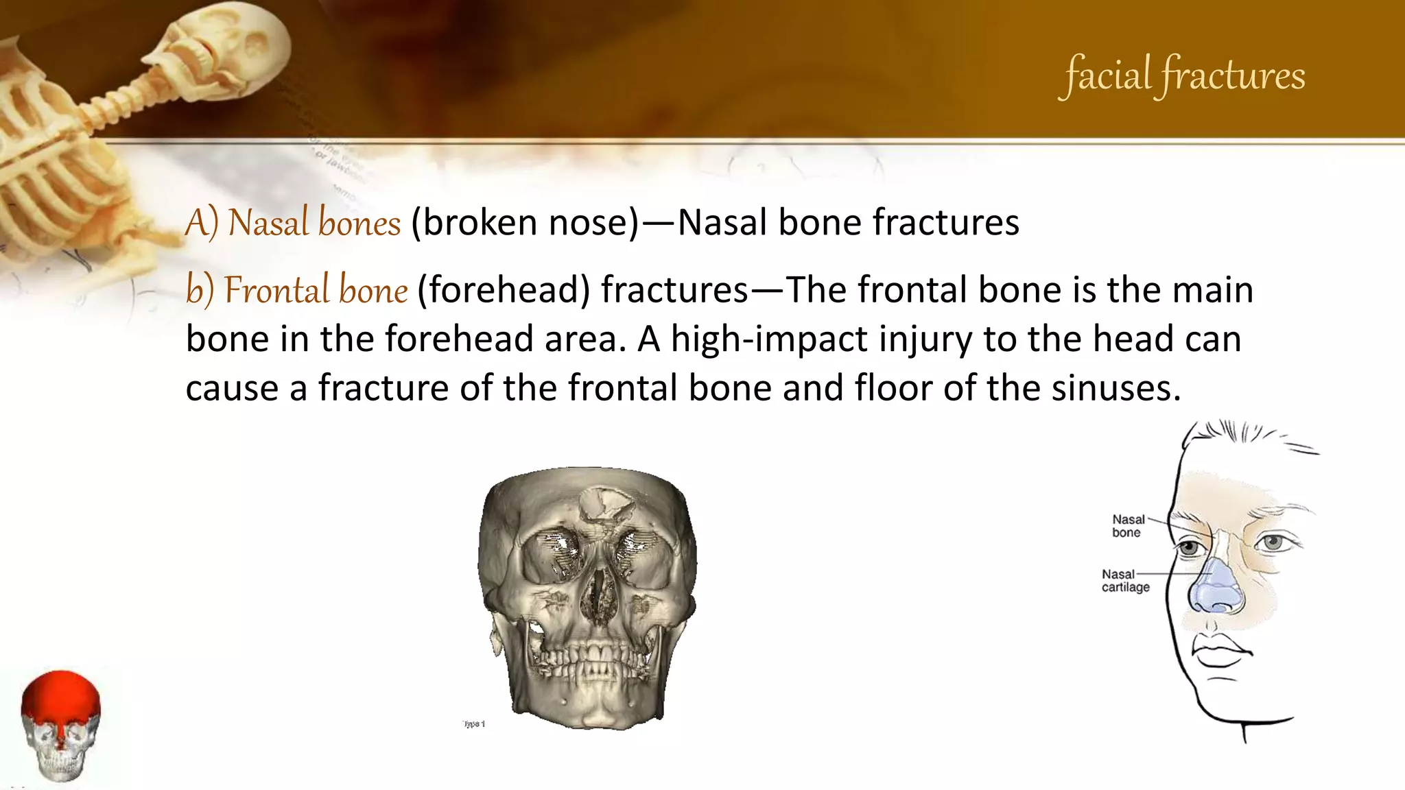 Clinical Anatomy of Skull (Presentation by Muhammad Arslan Yasin ...