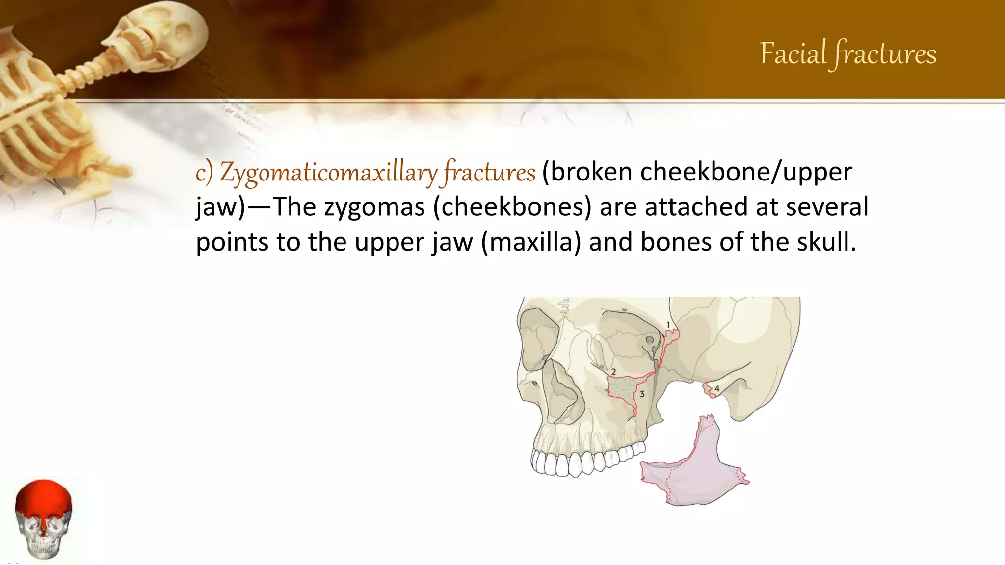 Clinical Anatomy of Skull (Presentation by Muhammad Arslan Yasin ...
