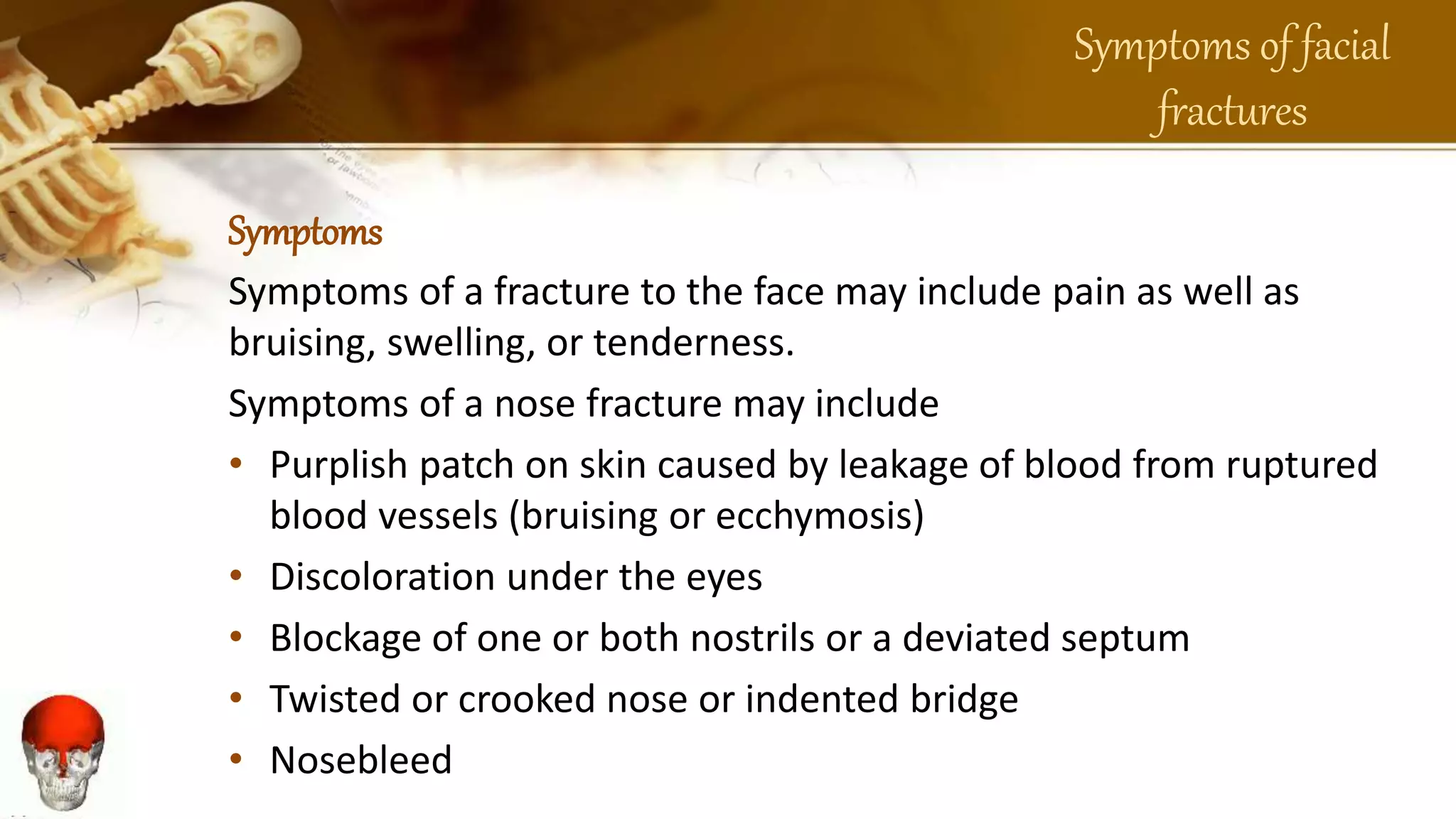 Clinical Anatomy of Skull (Presentation by Muhammad Arslan Yasin ...
