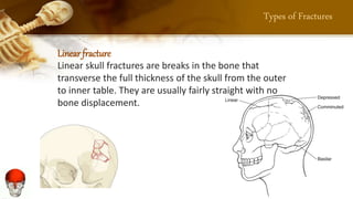 Clinical Anatomy of Skull (Presentation by Muhammad Arslan Yasin ...