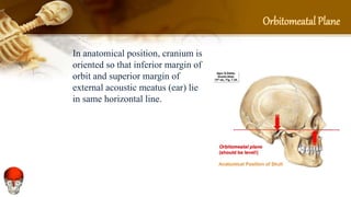 Clinical Anatomy of Skull (Presentation by Muhammad Arslan Yasin ...