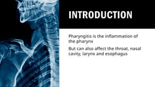 Pharyngitis , cause, definition and risk factors | PPTX