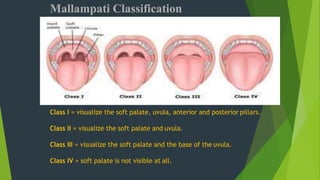 General anesthesia Presentation by Muhammad Saeed | PPTX