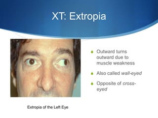 Abbreviations of the Ear and Eye | PPT