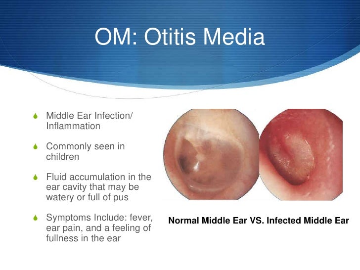 How To Chart An Ear Infection
