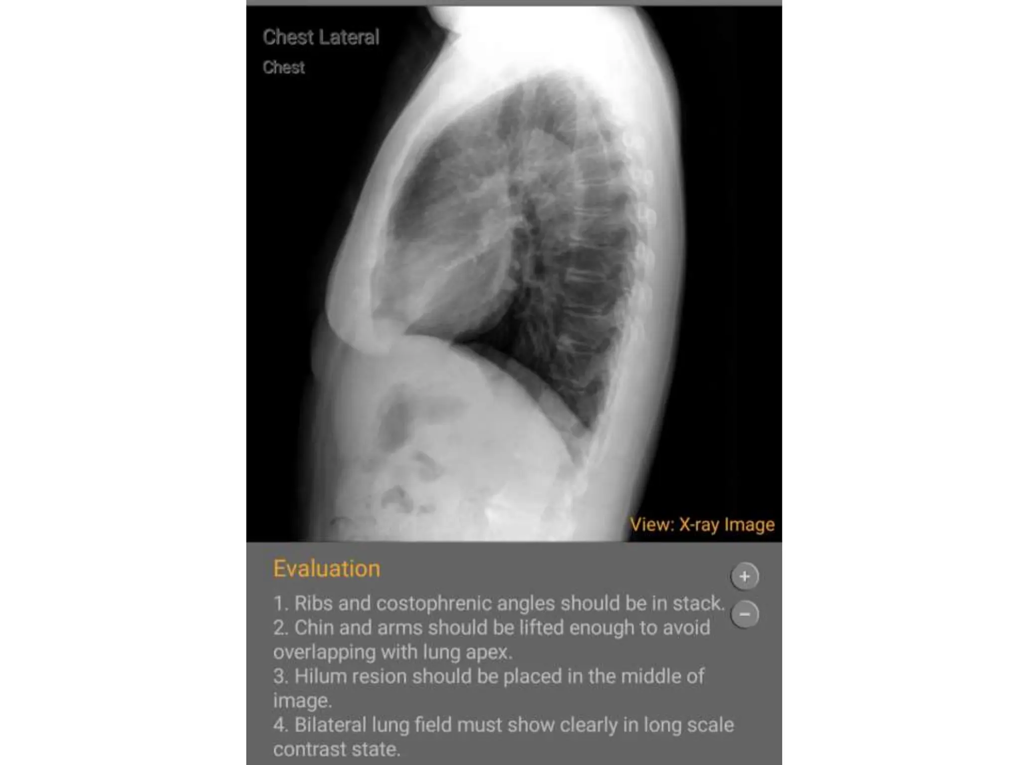 Presentation chest.pptx x ray positioning of chest | PPT