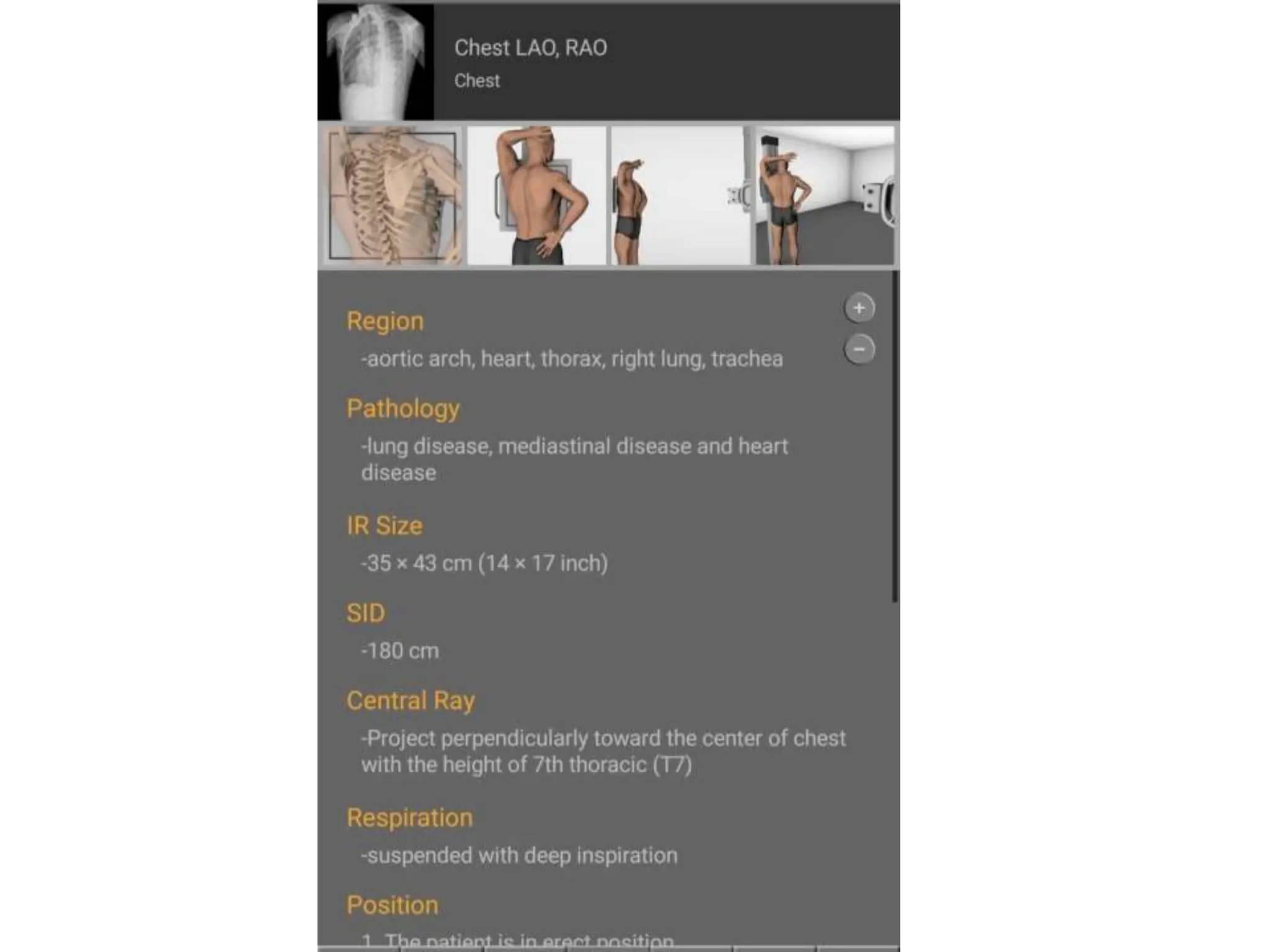 Presentation chest.pptx x ray positioning of chest | PPT