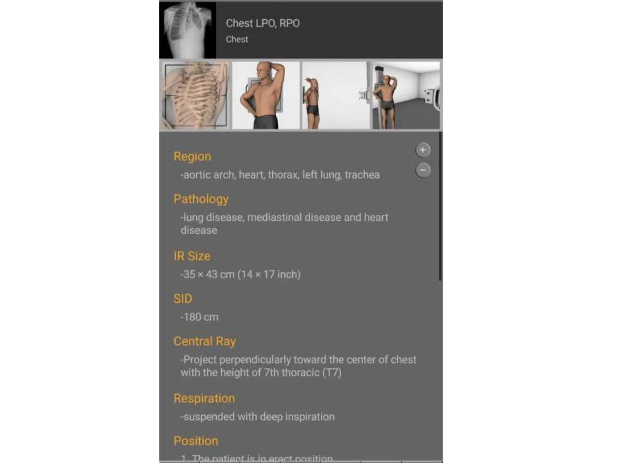 Presentation chest.pptx x ray positioning of chest | PPT