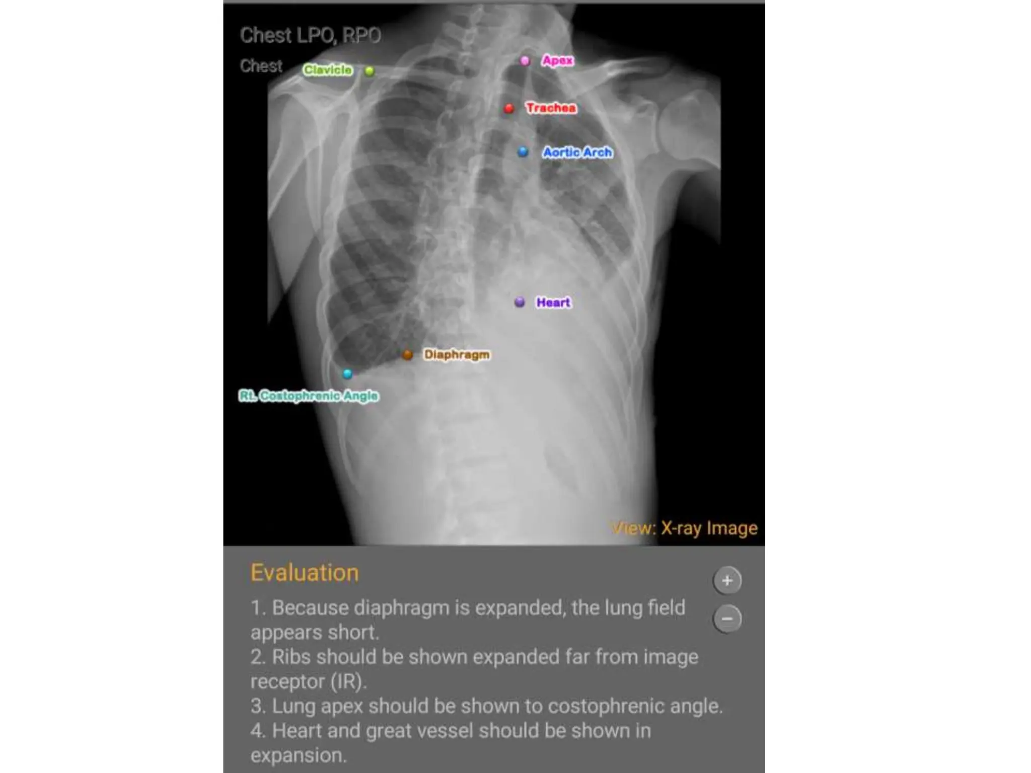 Presentation chest.pptx x ray positioning of chest | PPT