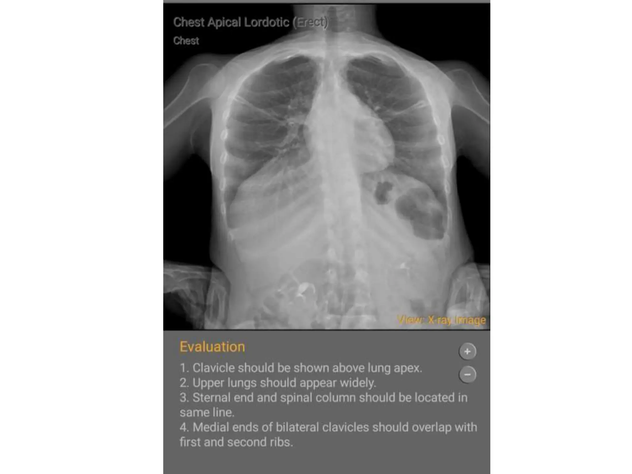 Presentation chest.pptx x ray positioning of chest | PPTX