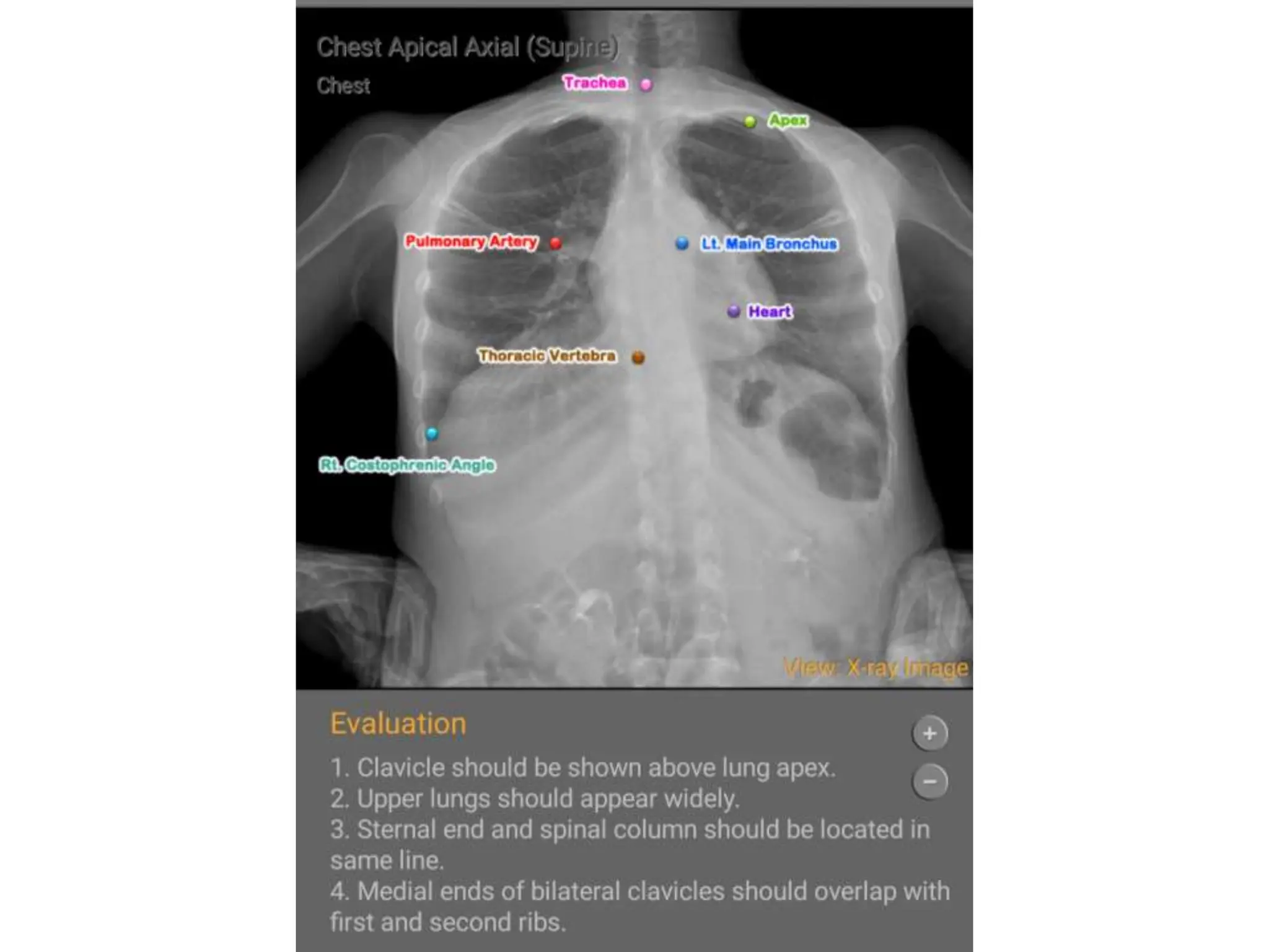 Presentation chest.pptx x ray positioning of chest | PPT