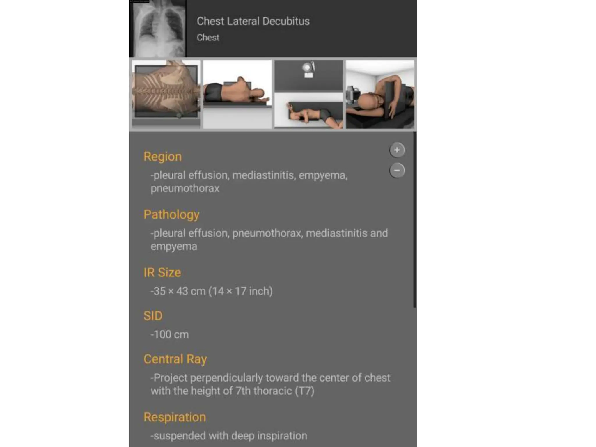 Presentation chest.pptx x ray positioning of chest | PPT