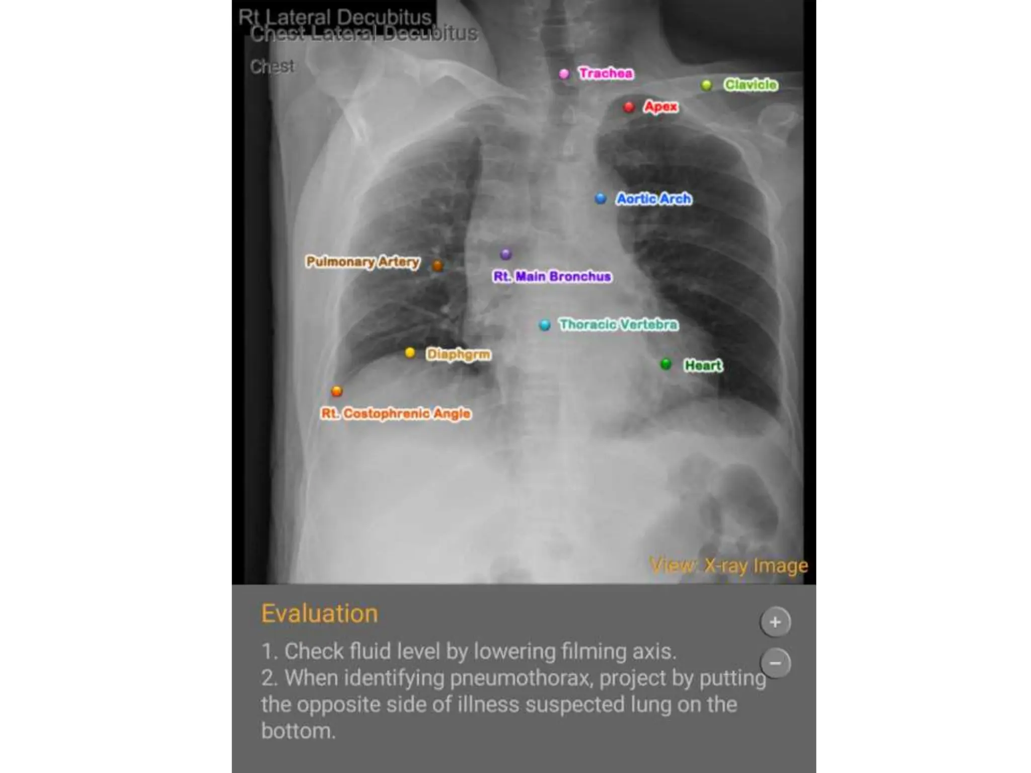 Presentation chest.pptx x ray positioning of chest | PPT