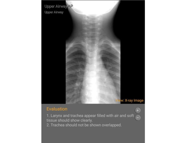 Presentation chest.pptx x ray positioning of chest | PPT