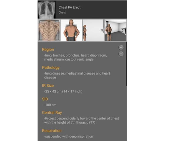 Presentation chest.pptx x ray positioning of chest | PPT