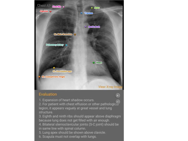 Presentation chest.pptx x ray positioning of chest | PPTX