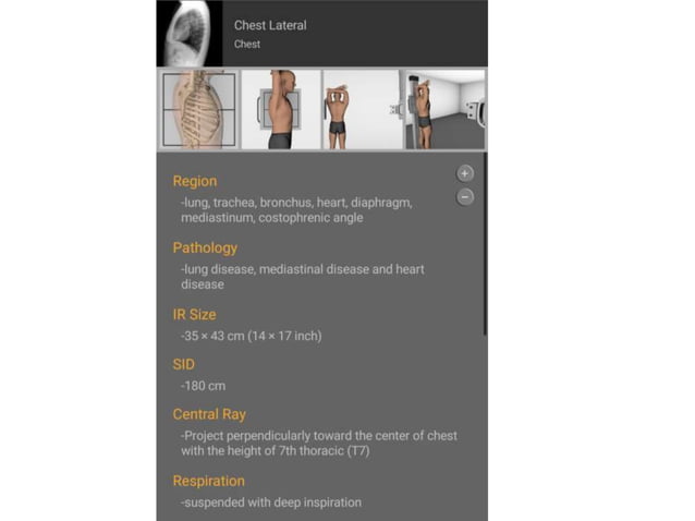 Presentation chest.pptx x ray positioning of chest | PPTX