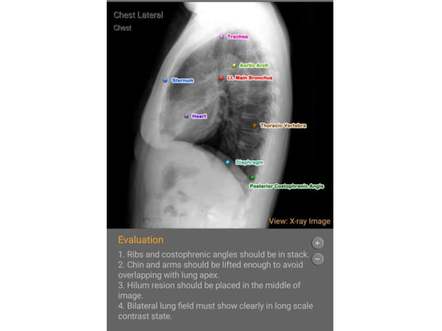 Presentation chest.pptx x ray positioning of chest | PPTX
