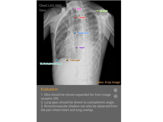 Presentation chest.pptx x ray positioning of chest | PPTX