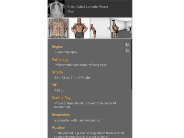 Presentation chest.pptx x ray positioning of chest | PPT