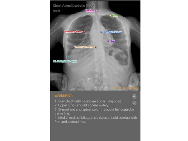Presentation chest.pptx x ray positioning of chest | PPT